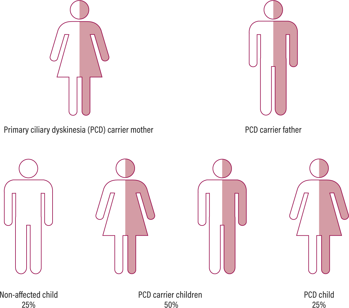Diagnosis and management of children with primary ciliary dyskinesia