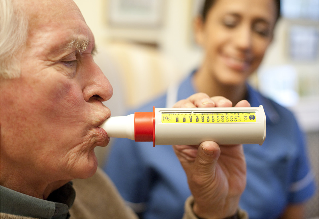 Peak Expiratory Flow Rate: Purpose, Preparation, And, 60% OFF